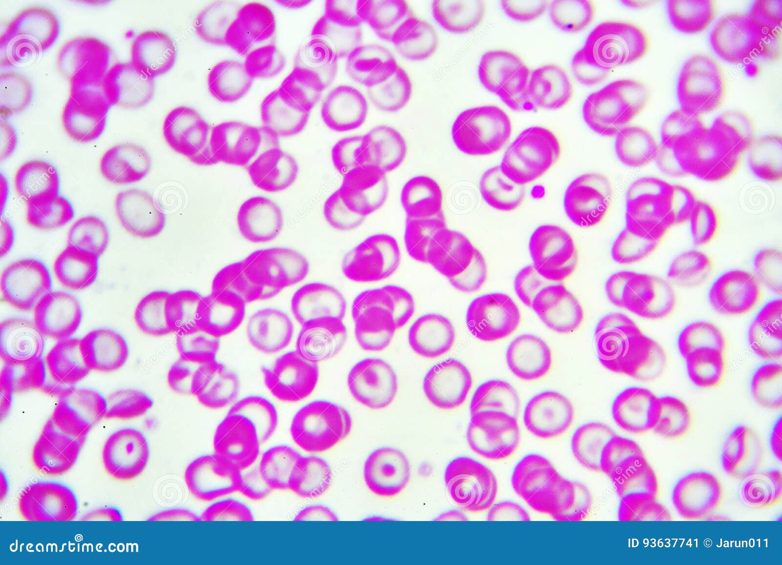 Analyzing Abnormal Cell Structures And Tissues Using Advanced ...