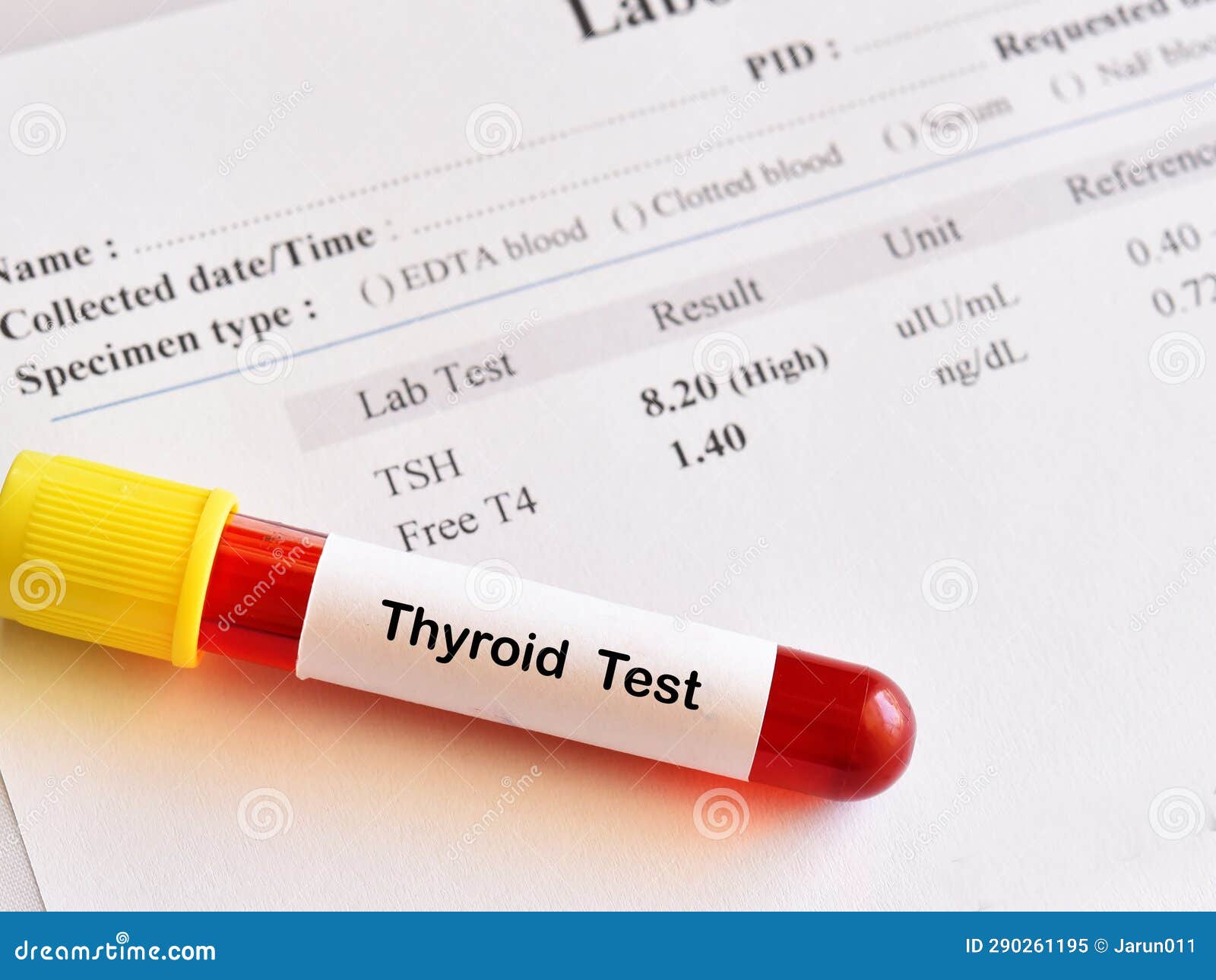 Abnormal Thyroid Hormone Result Stock Image - Image of goiter, report ...