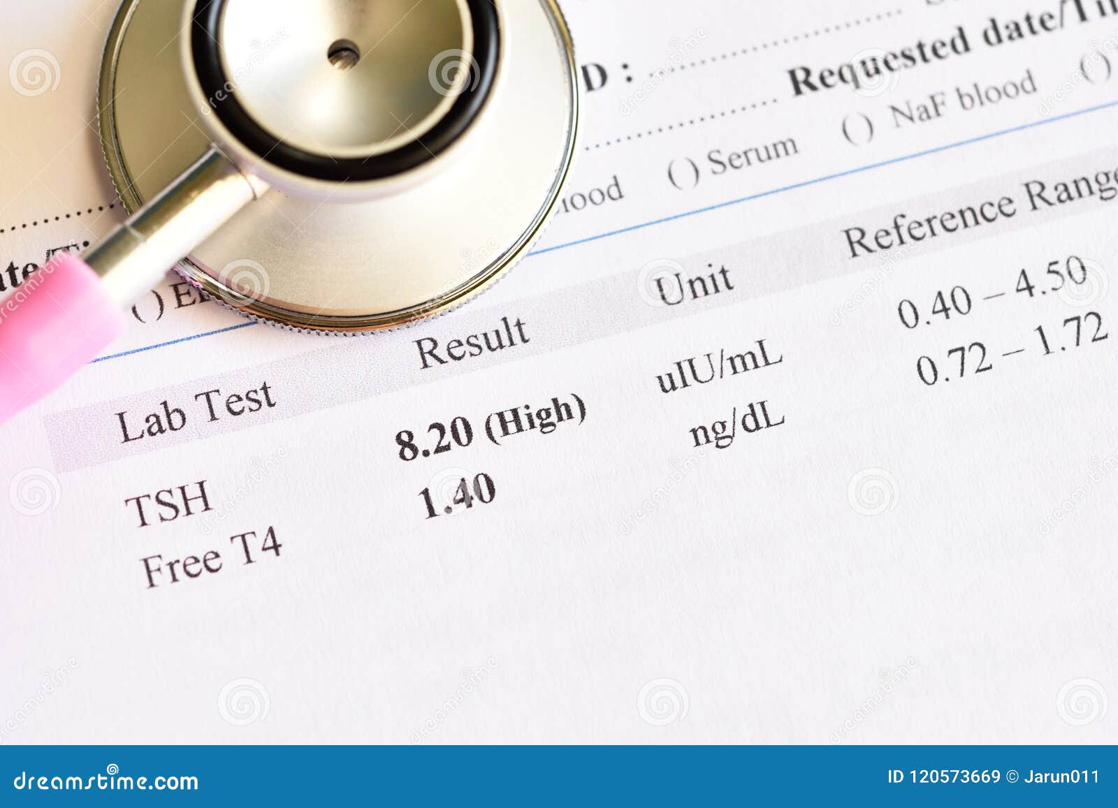 Abnormal Thyroid Hormone Test Result Stock Image - Image of laboratory ...