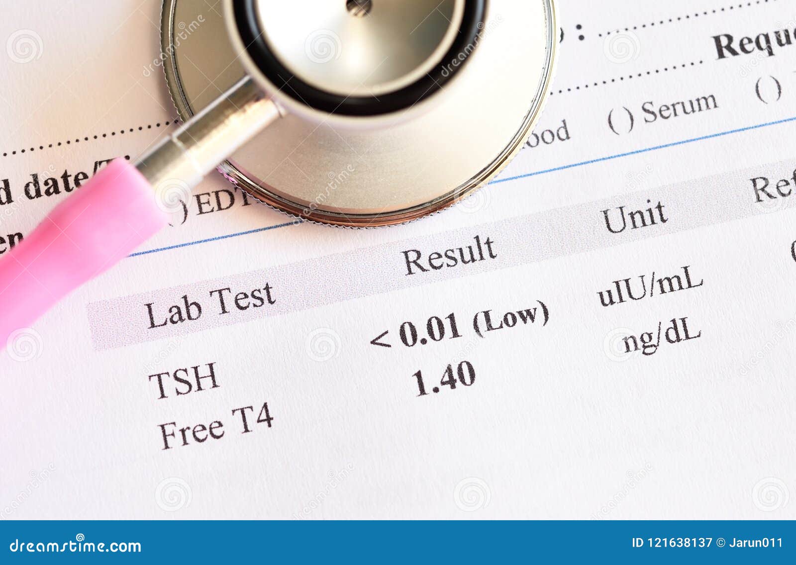 Abnormal Thyroid Hormone Test Result Stock Image - Image of normal ...