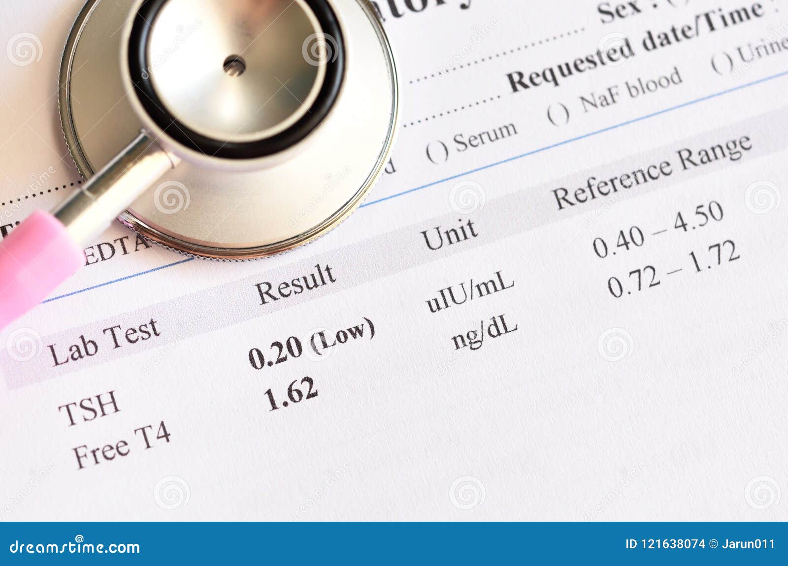 Abnormal Thyroid Hormone Test Result Stock Photo - Image of pituitary ...