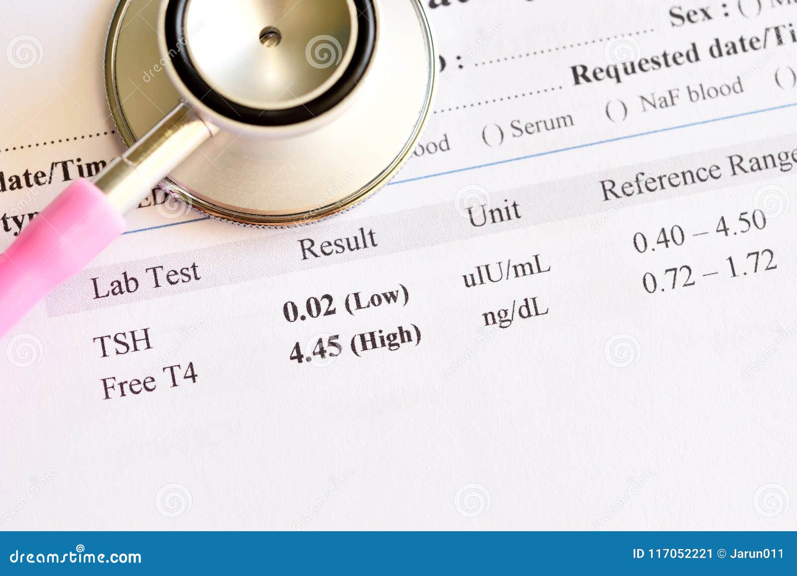 Abnormal Thyroid Hormone Test Result with Stethoscope Stock Image ...