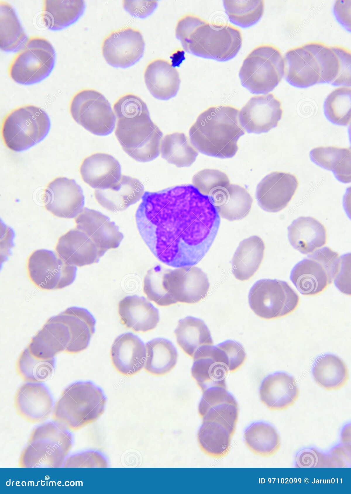 Analyzing Abnormal Cell Structures And Tissues Using Advanced ...