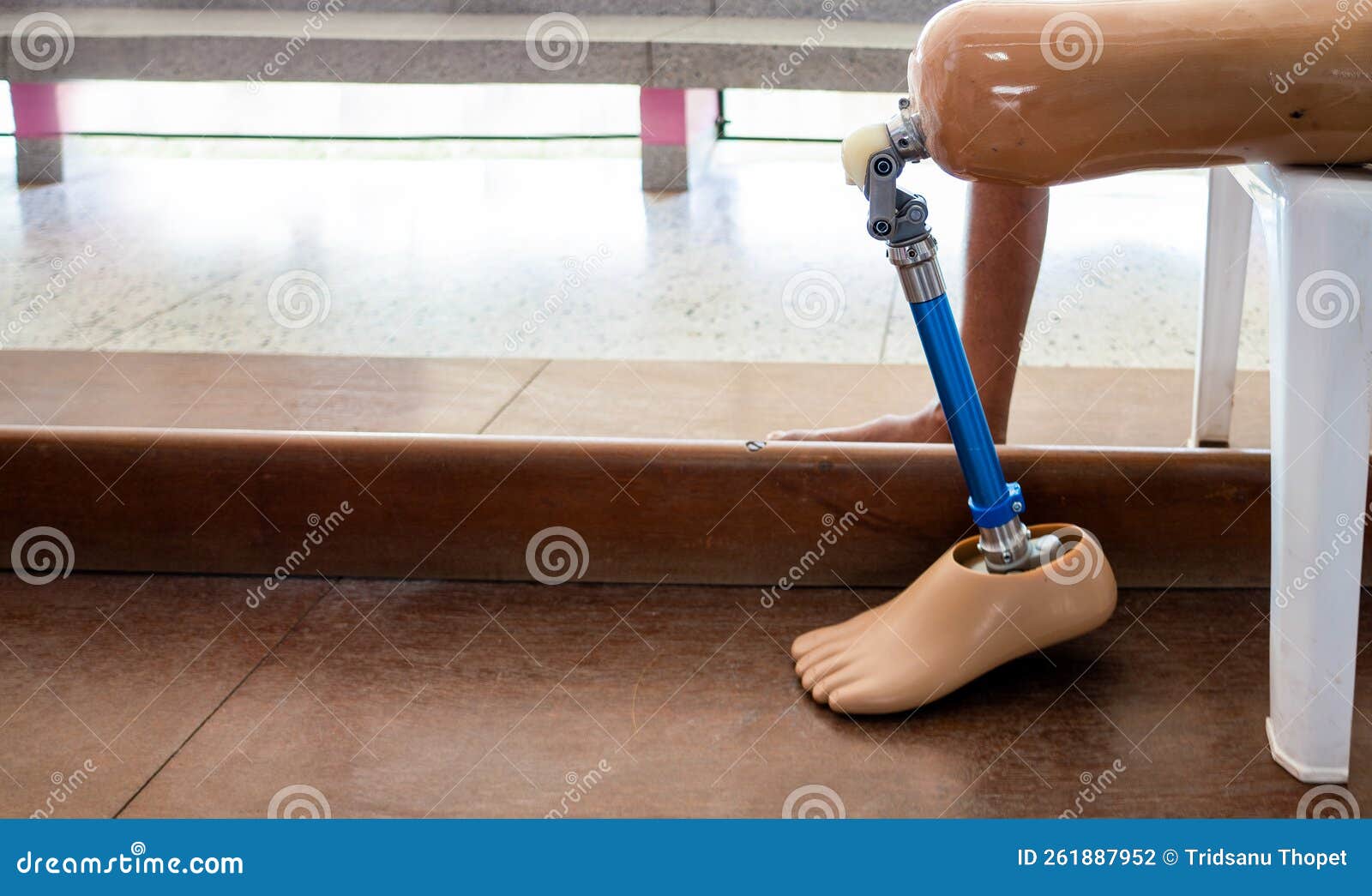 Above Knee Amputation Using AK Prothesis Device Stock Photo - Image of ...