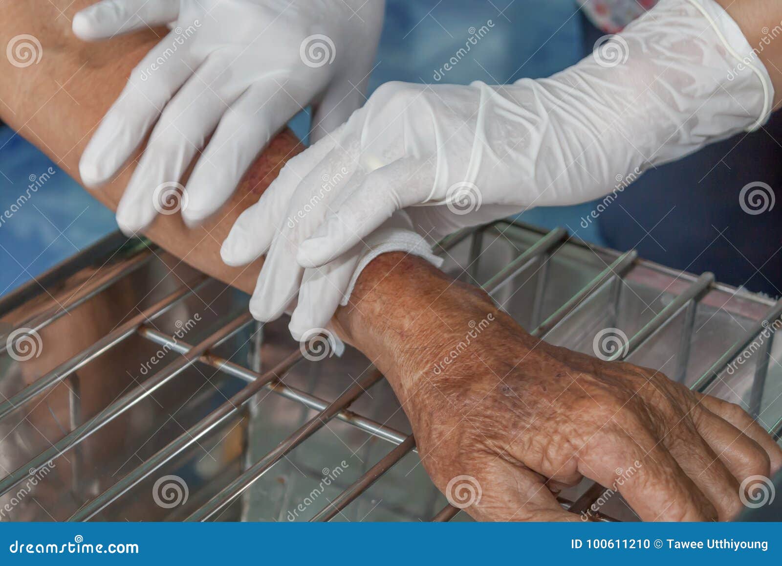 Abrasion wound arm stock photo. Image of background - 100611210