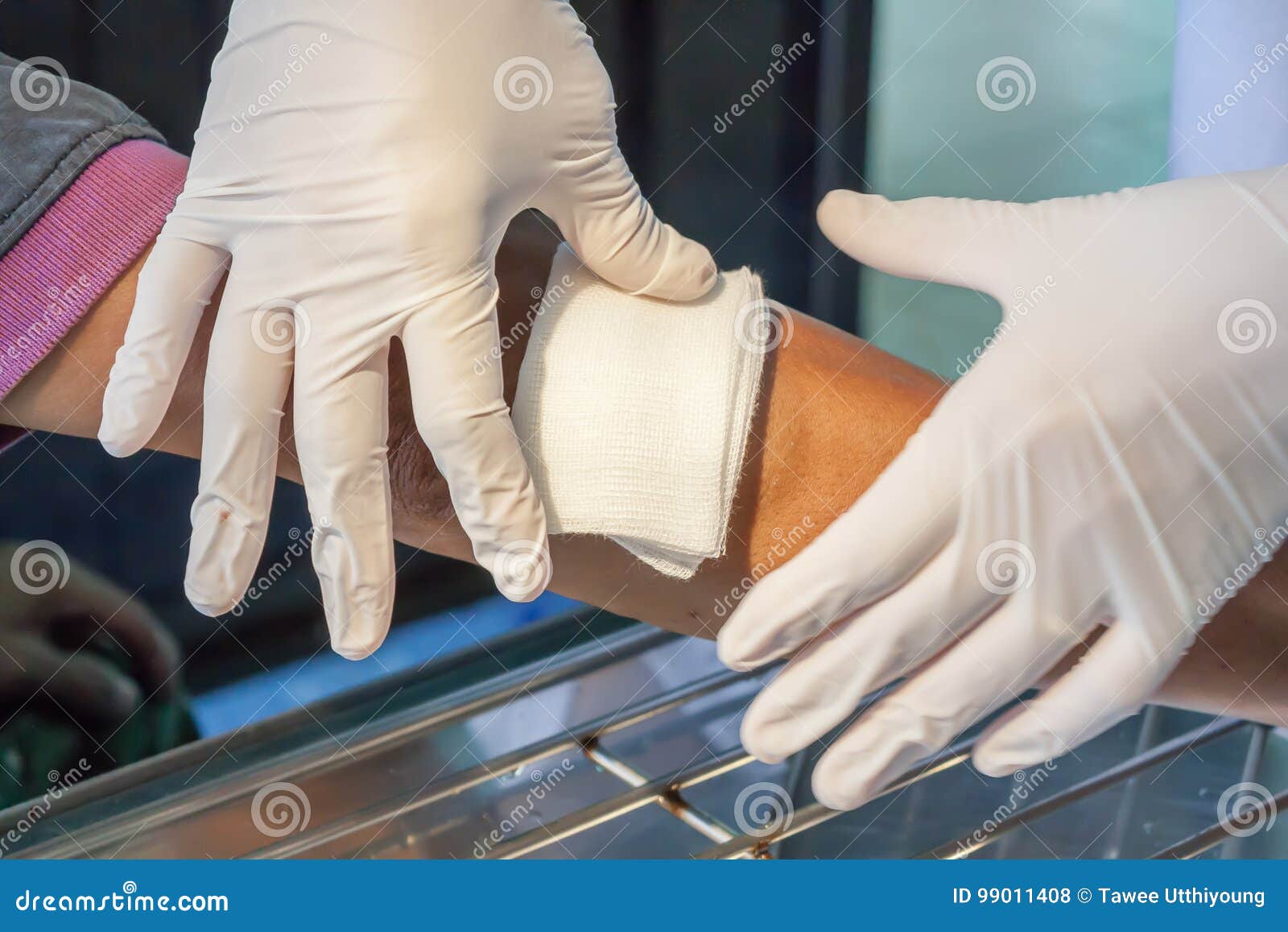 Abrasion wound arm injury stock photo. Image of abrasion - 99011408