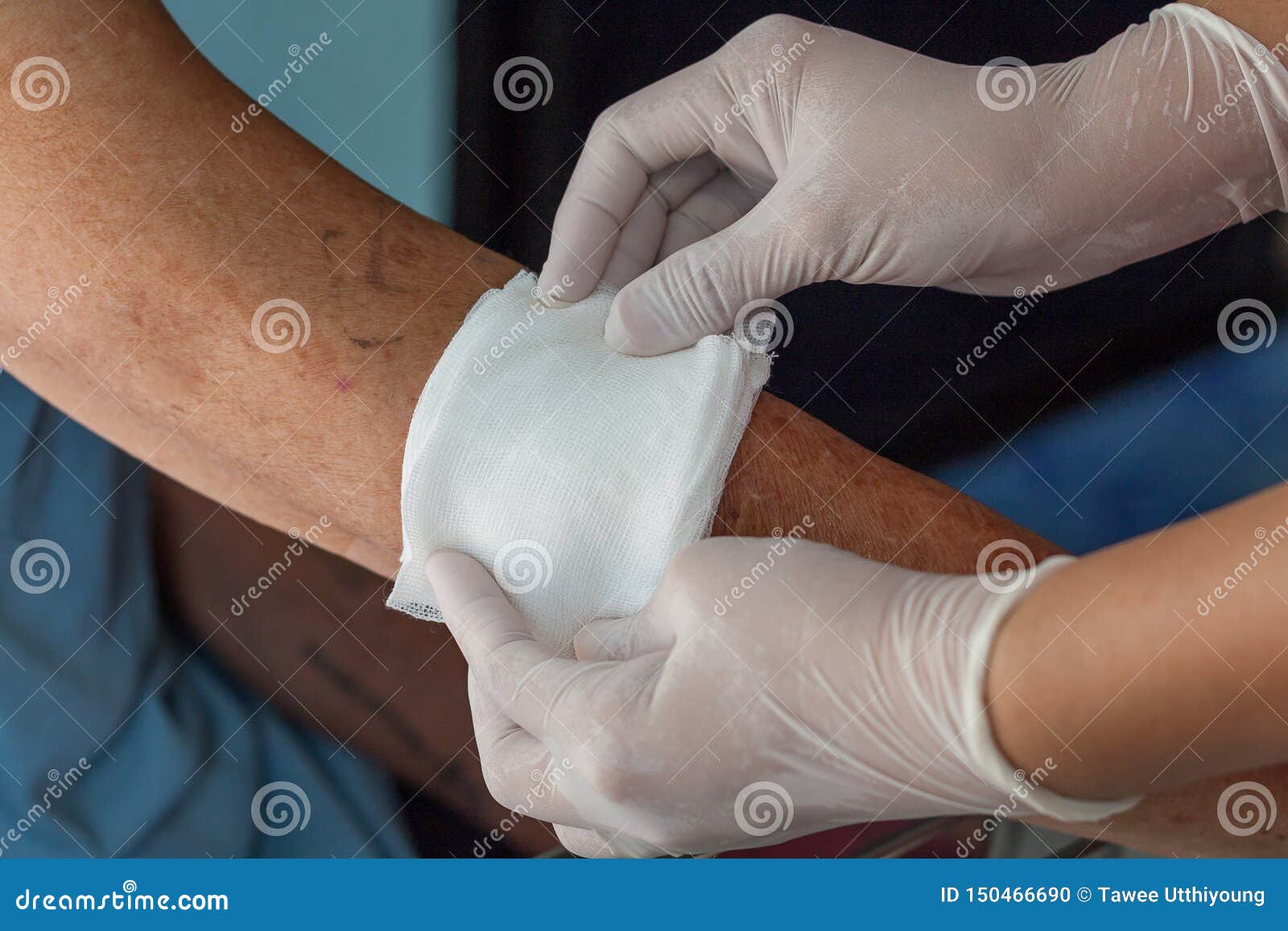 Abrasion wound man stock photo. Image of accident, scrape - 150466690
