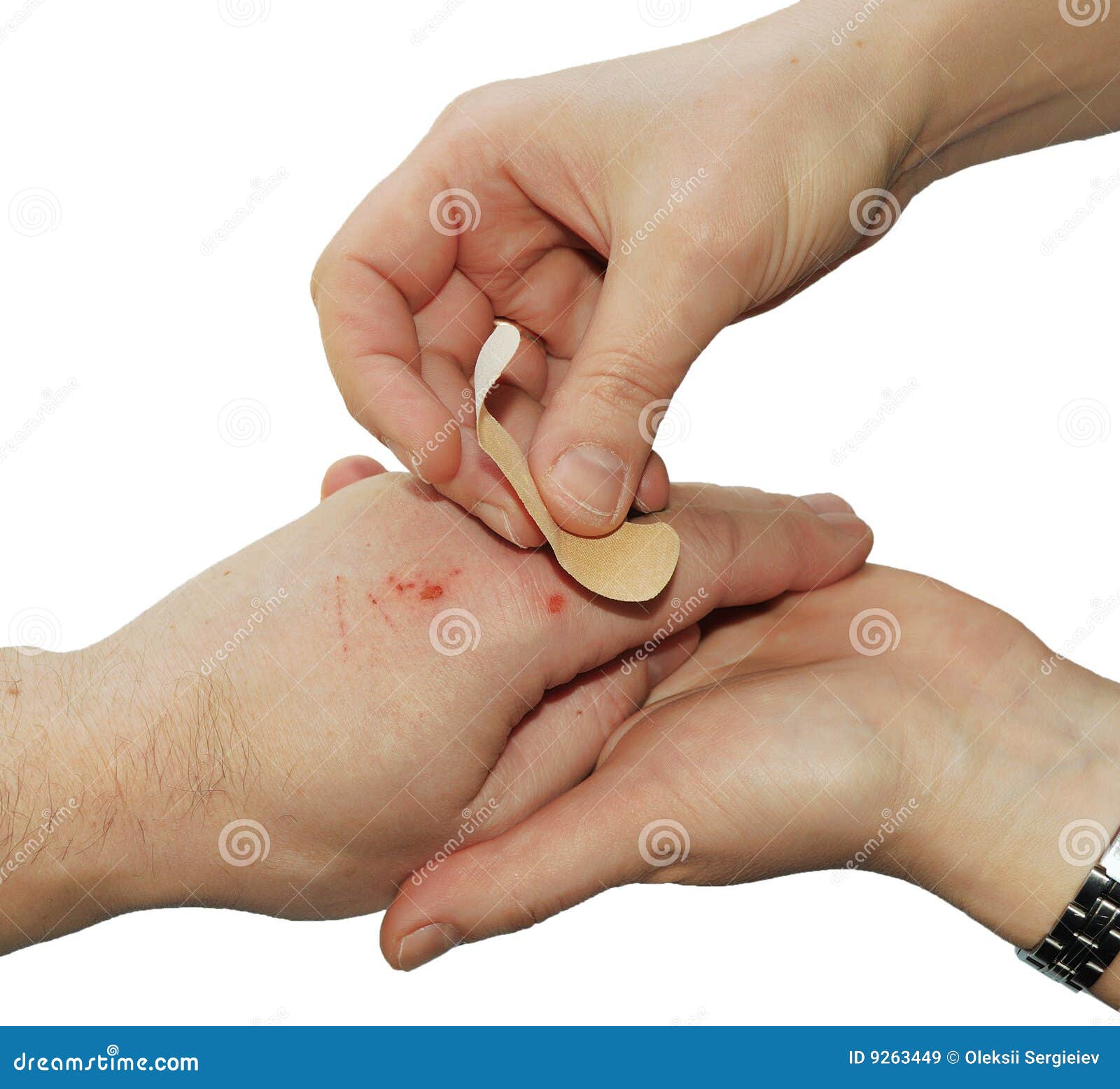Abrasional male hand stock image. Image of injury, healthcare - 9263449