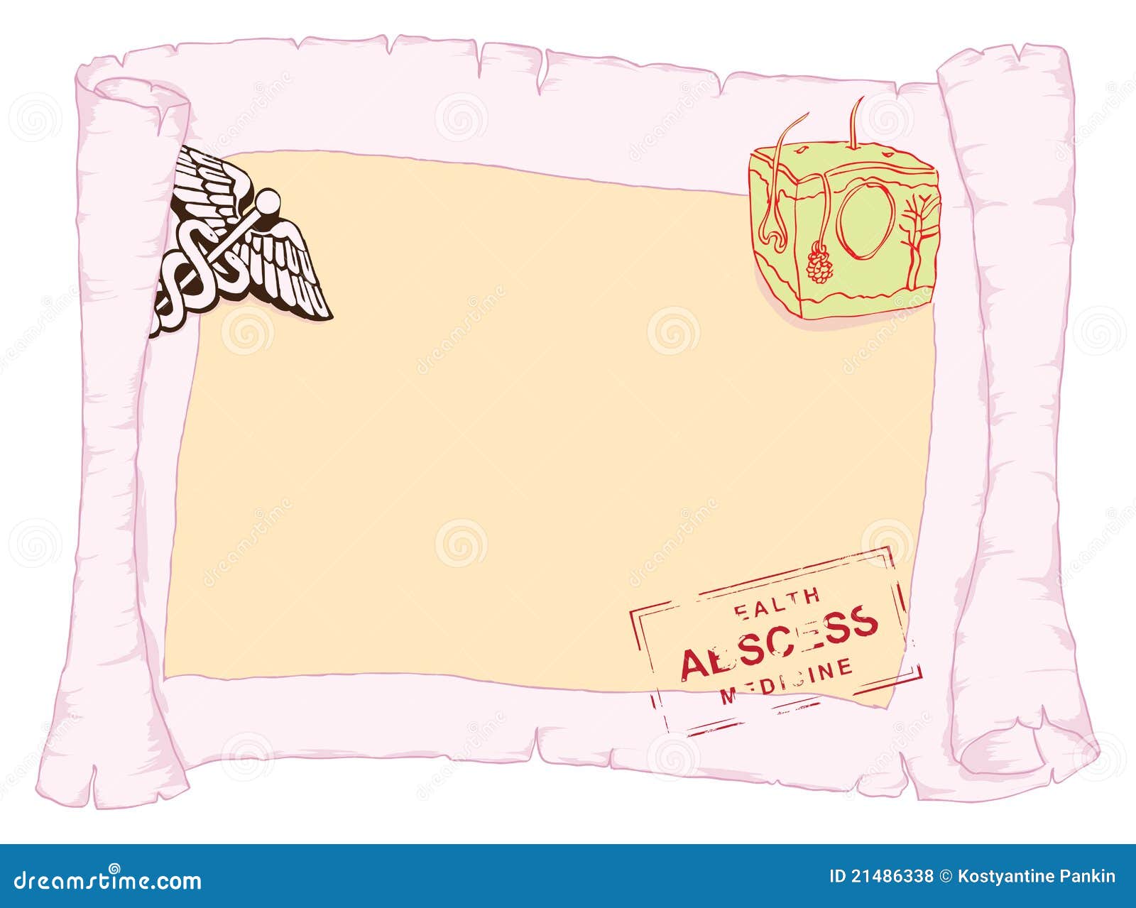 Abscess stock vector. Illustration of heartiness, apostasis - 21486338