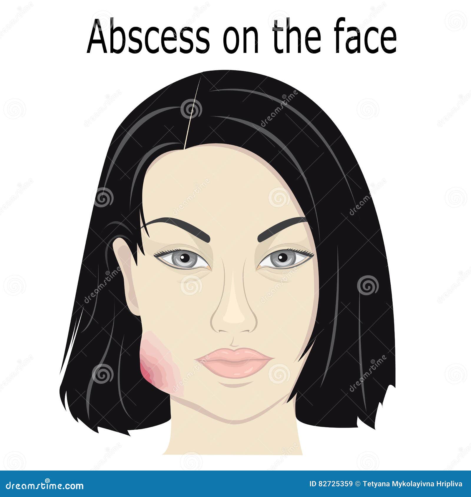 Abscess Cartoons, Illustrations & Vector Stock Images - 2242 Pictures ...