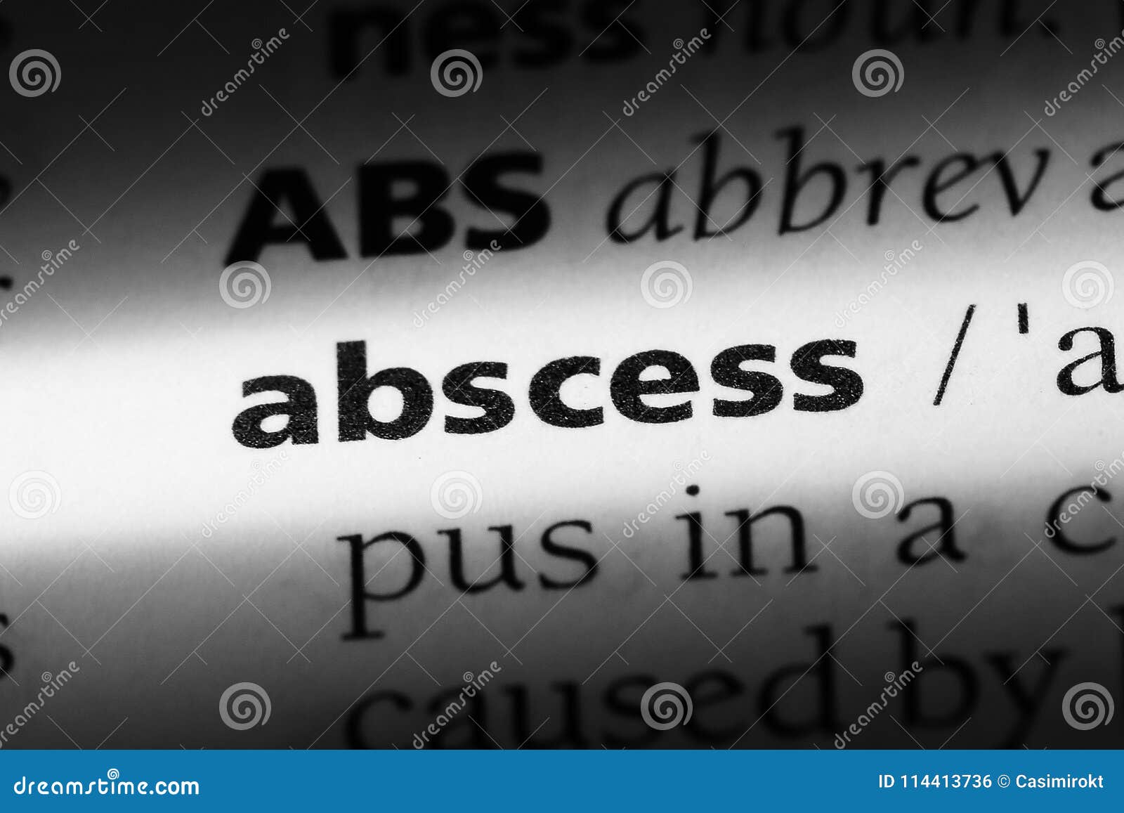 Abscess Word in a Dictionary. Abscess Concept Stock Photo - Image of ...