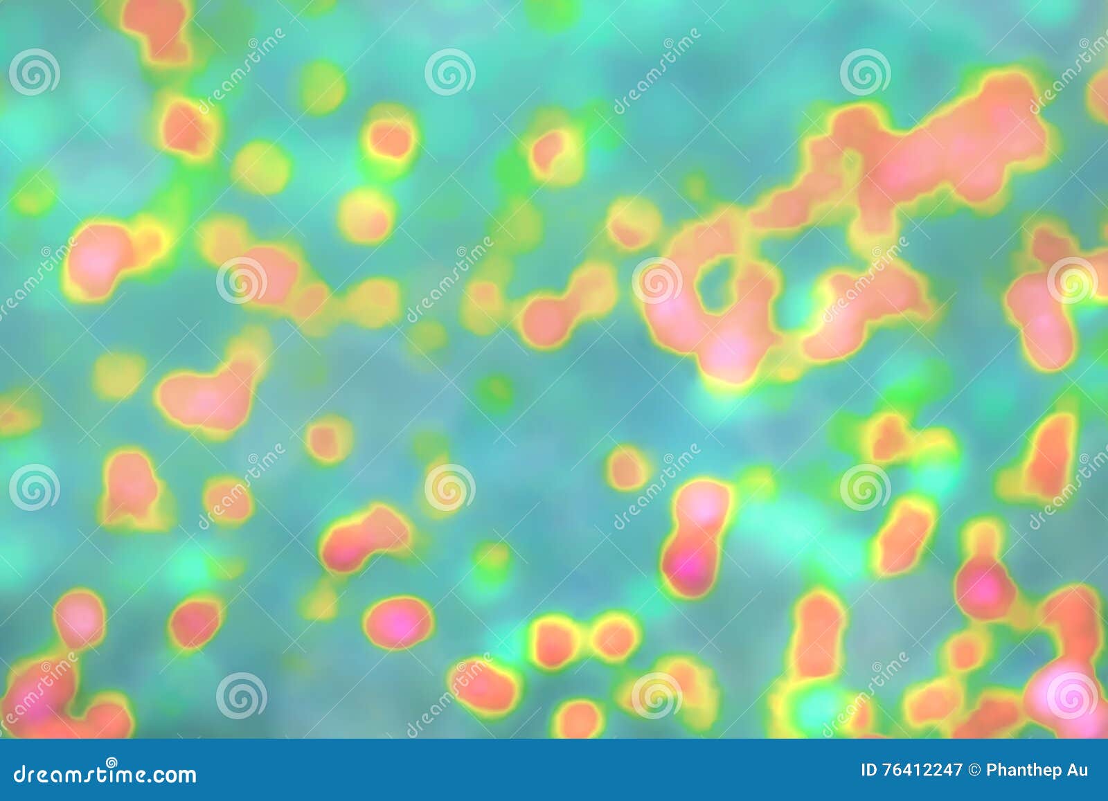 Abstract Blur Infectious Diseases Spread (background) Stock ...
