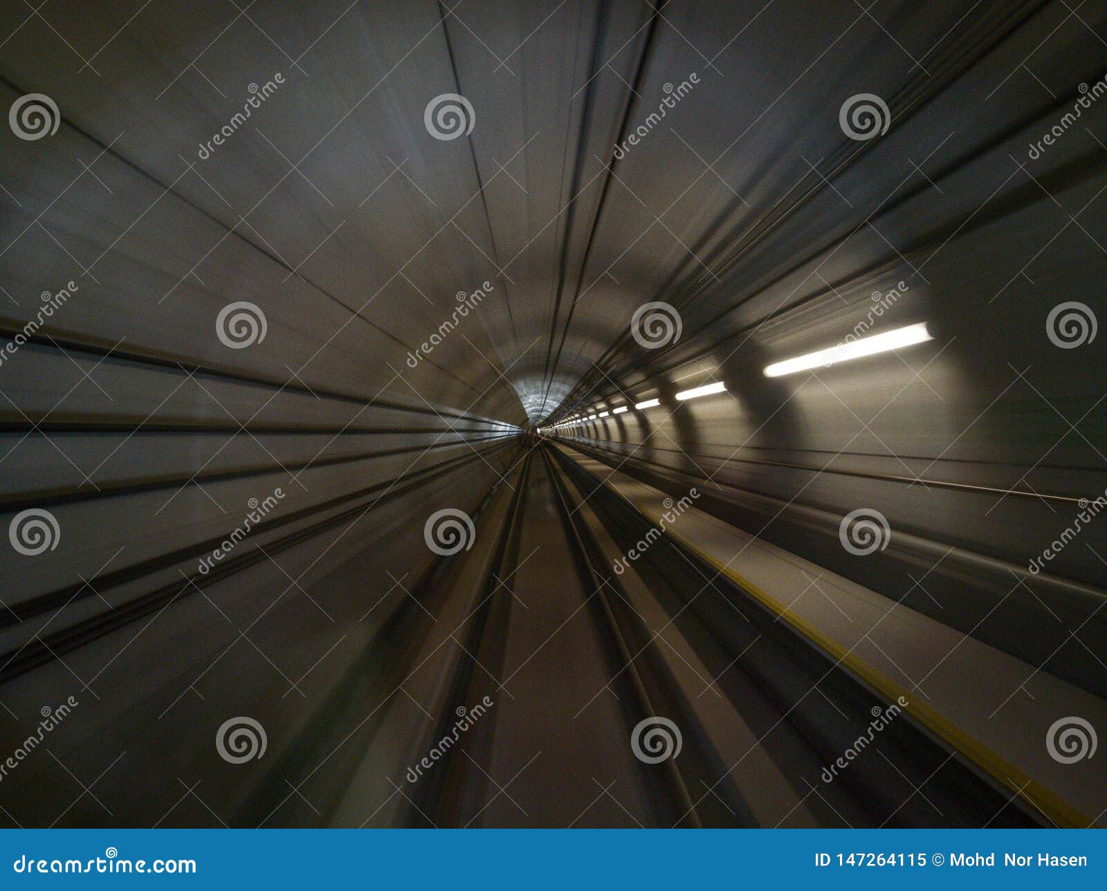 Abstract Effect of MRT Movement, Image Has Grain or Blurry or Noise and ...