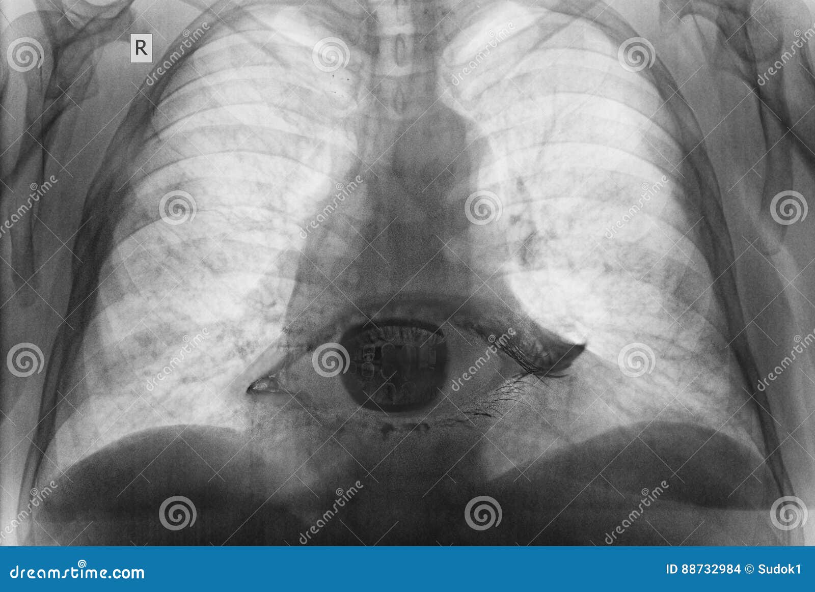 Abstract Image of the Third Eye Combined with an X-ray of the Ch Stock ...