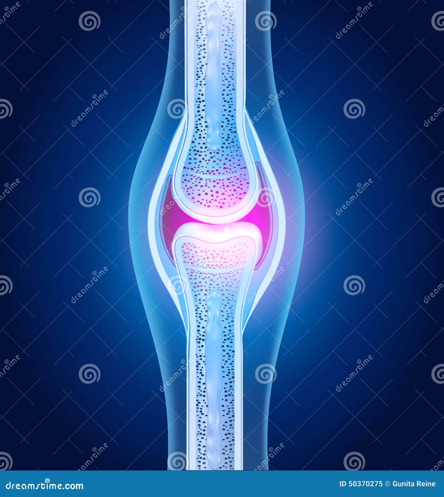 Abstract joint background stock vector. Illustration of reontgen - 50370275