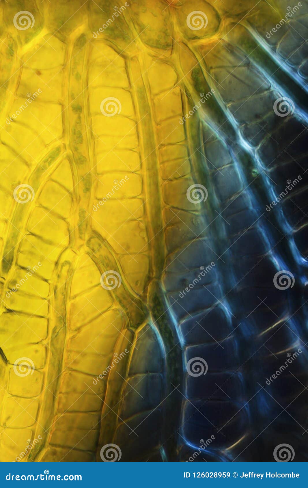 Abstract Micrograph of Linear Cells in a Peat Moss Leaf. Stock Image ...