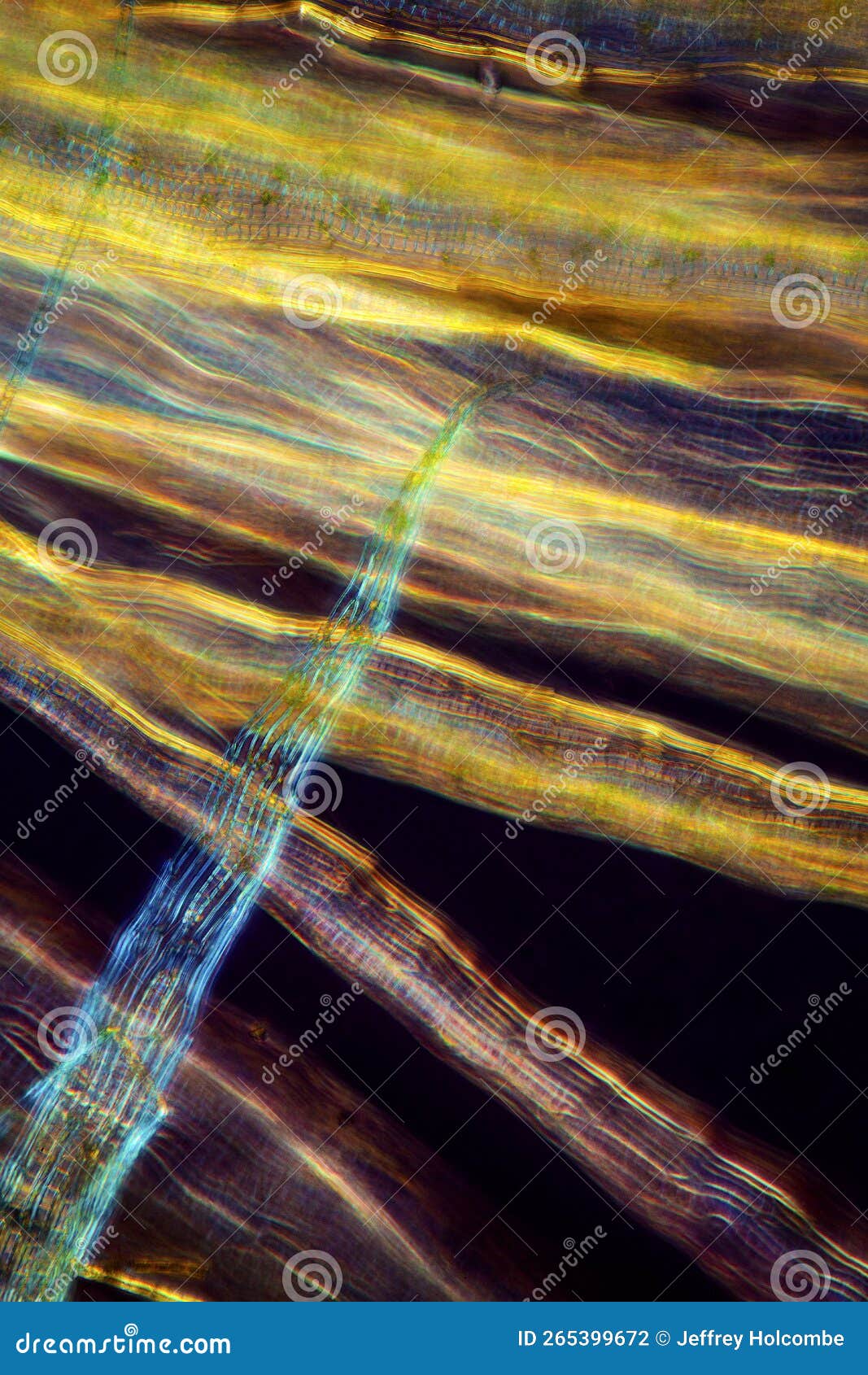 Abstract Micrograph of Peat Moss Leaves, with Polarization Stock Photo ...