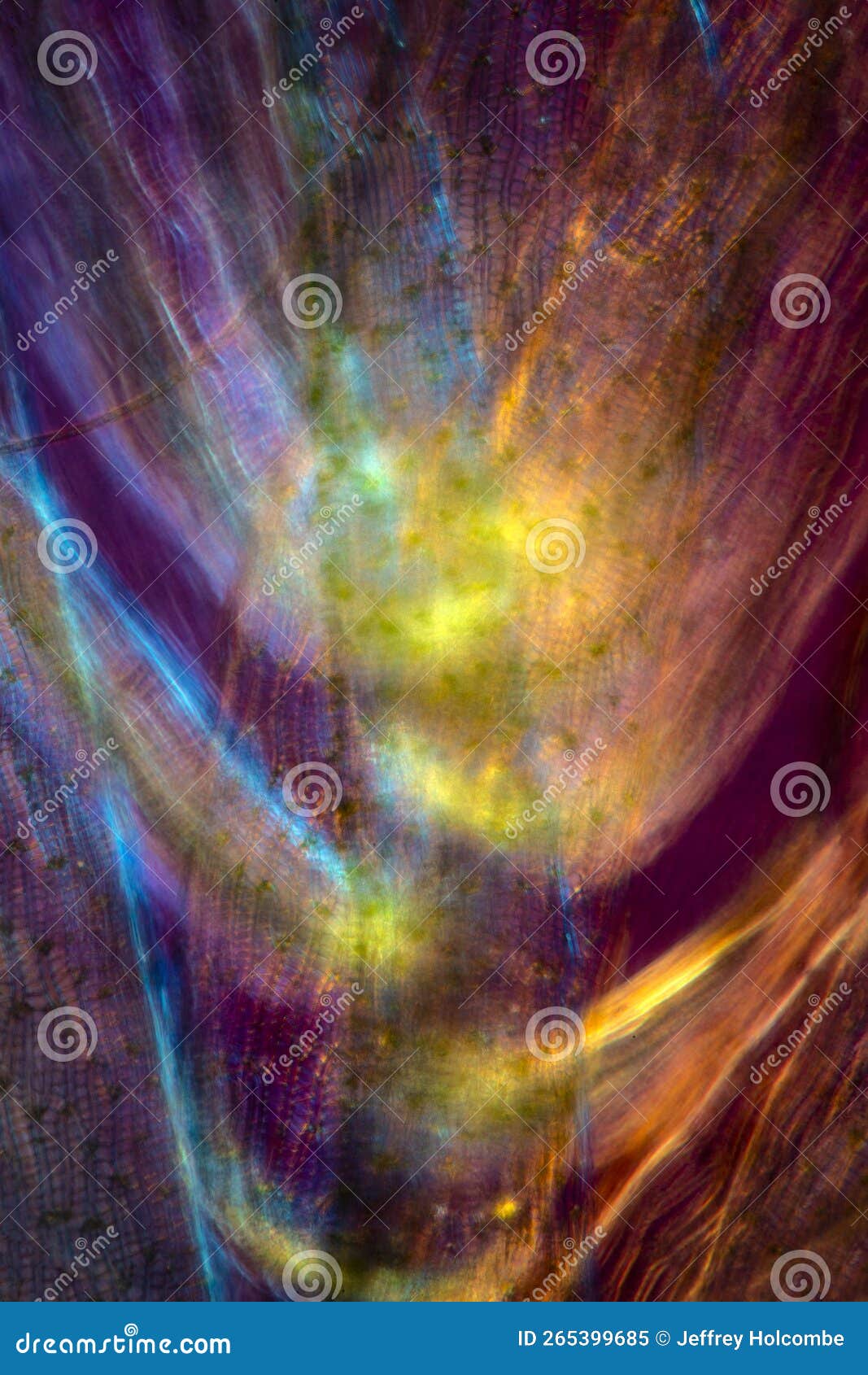 Abstract Micrograph of Peat Moss Leaves, with Polarization Stock Image ...