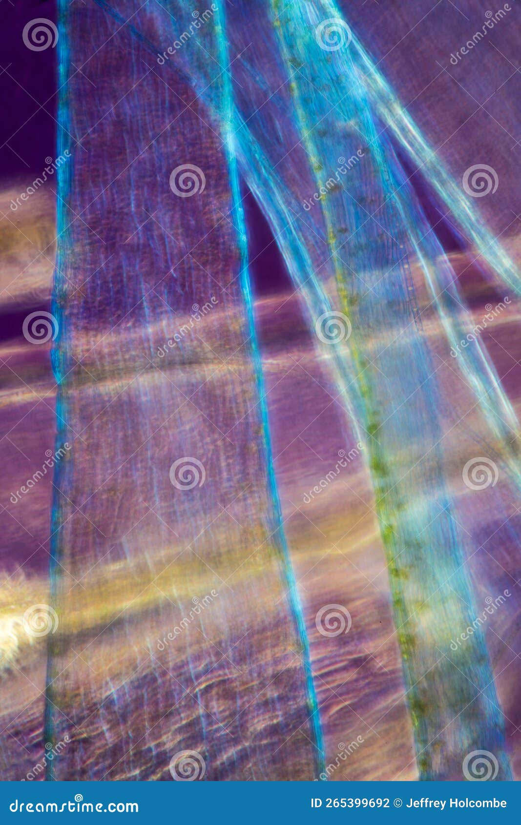 Abstract Micrograph of Peat Moss Leaves, with Polarization Stock Photo ...