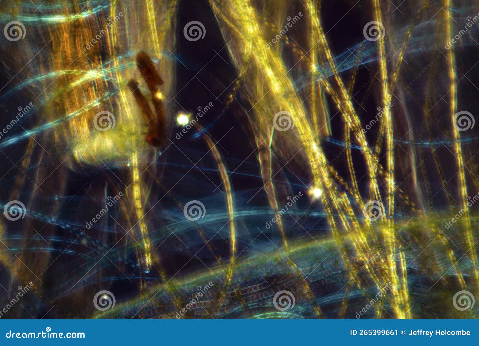 Abstract Micrograph of Peat Moss Leaves, with Polarization Stock Image ...