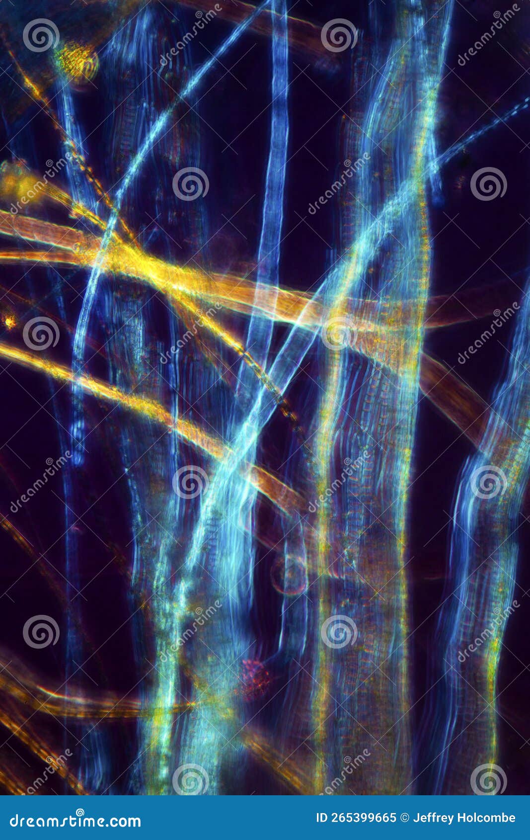 Abstract Micrograph of Peat Moss Leaves, with Polarization Stock Image ...