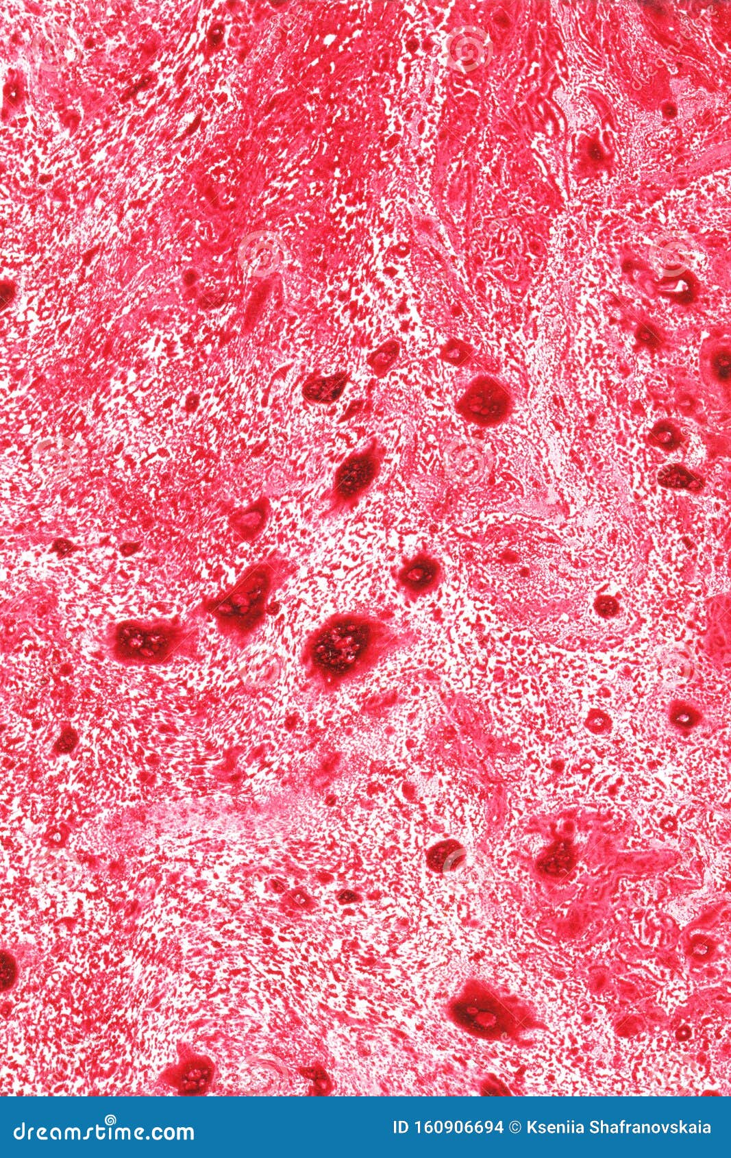 Abstract Red Spots Marble Background Stock Photo - Image of nature ...