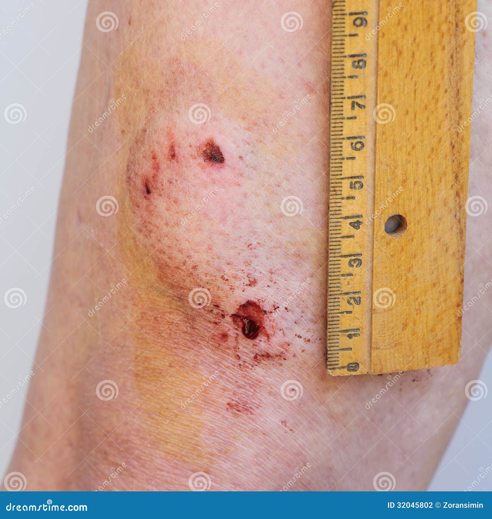 Accident with dog stock photo. Image of care, injury - 32045802