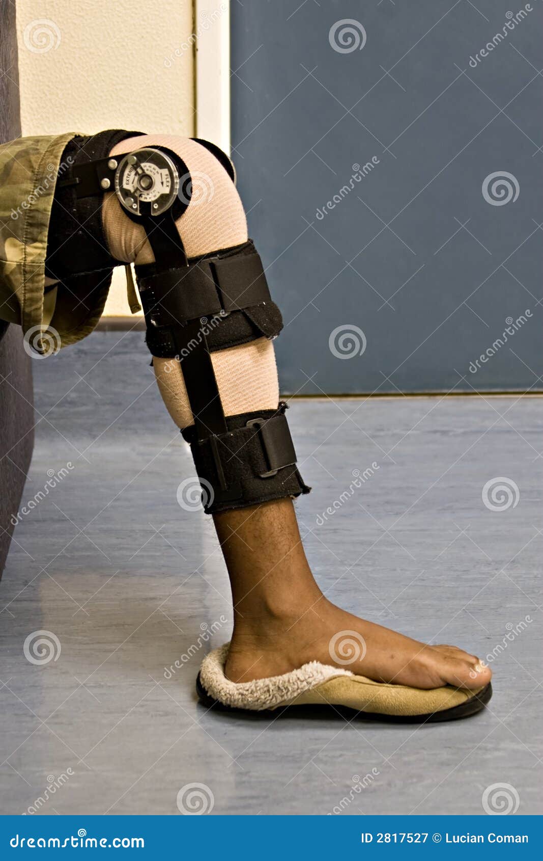 Accident victim stock image. Image of hospital, orthopedic - 2817527