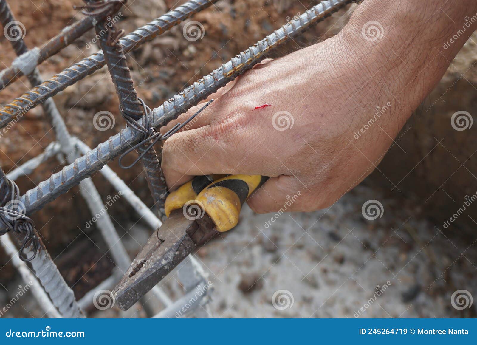 The Back of the Hand Was a Fresh Wound and Bleeding Caused by a Steel ...