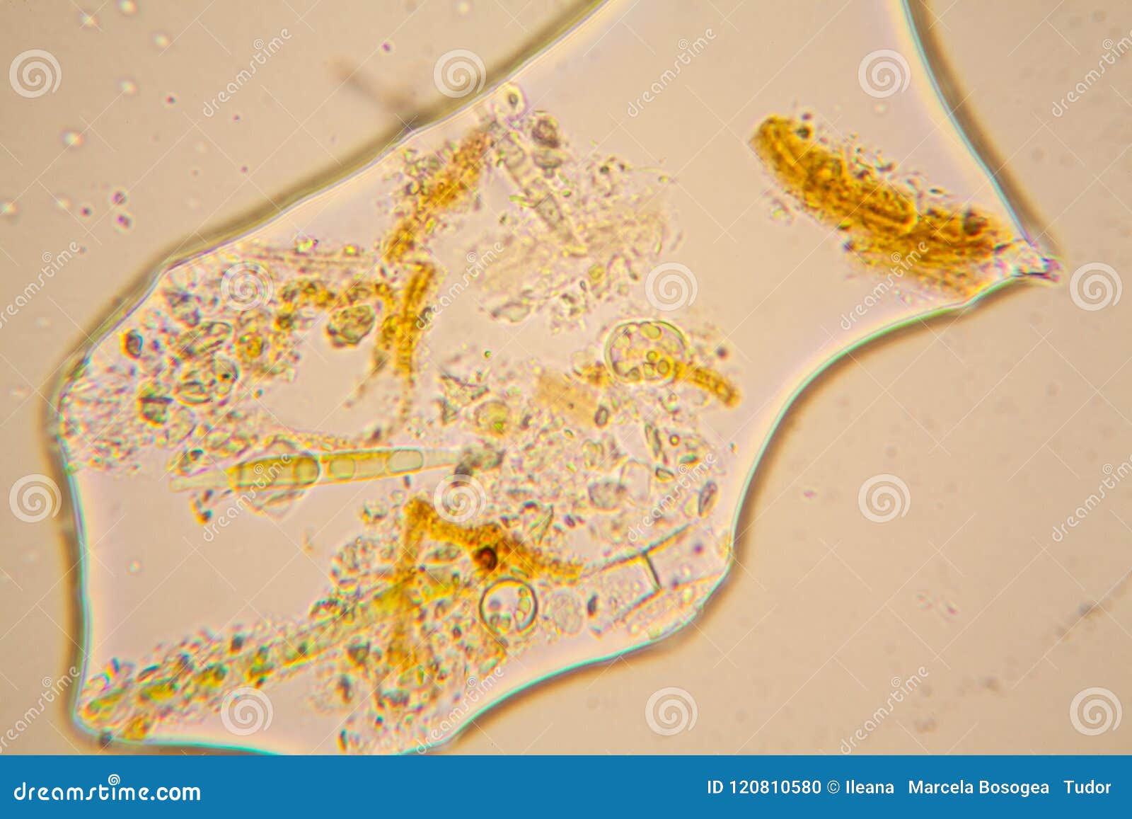 Accumulez Le Plancton Et Les Algues De L'eau Au Microscope Diatomées ...