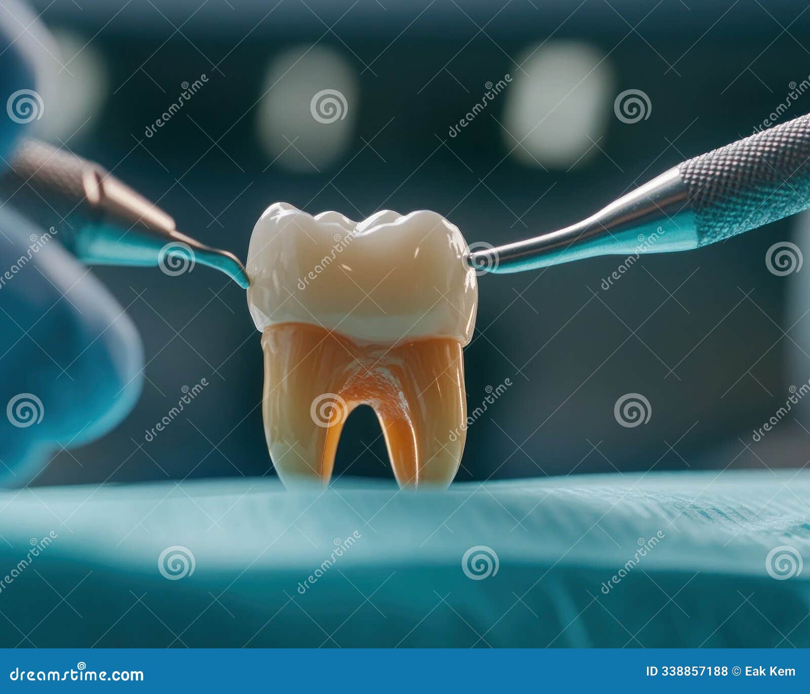 Dental Procedure Precise Alignment of Prosthetic Tooth for a Perfect ...