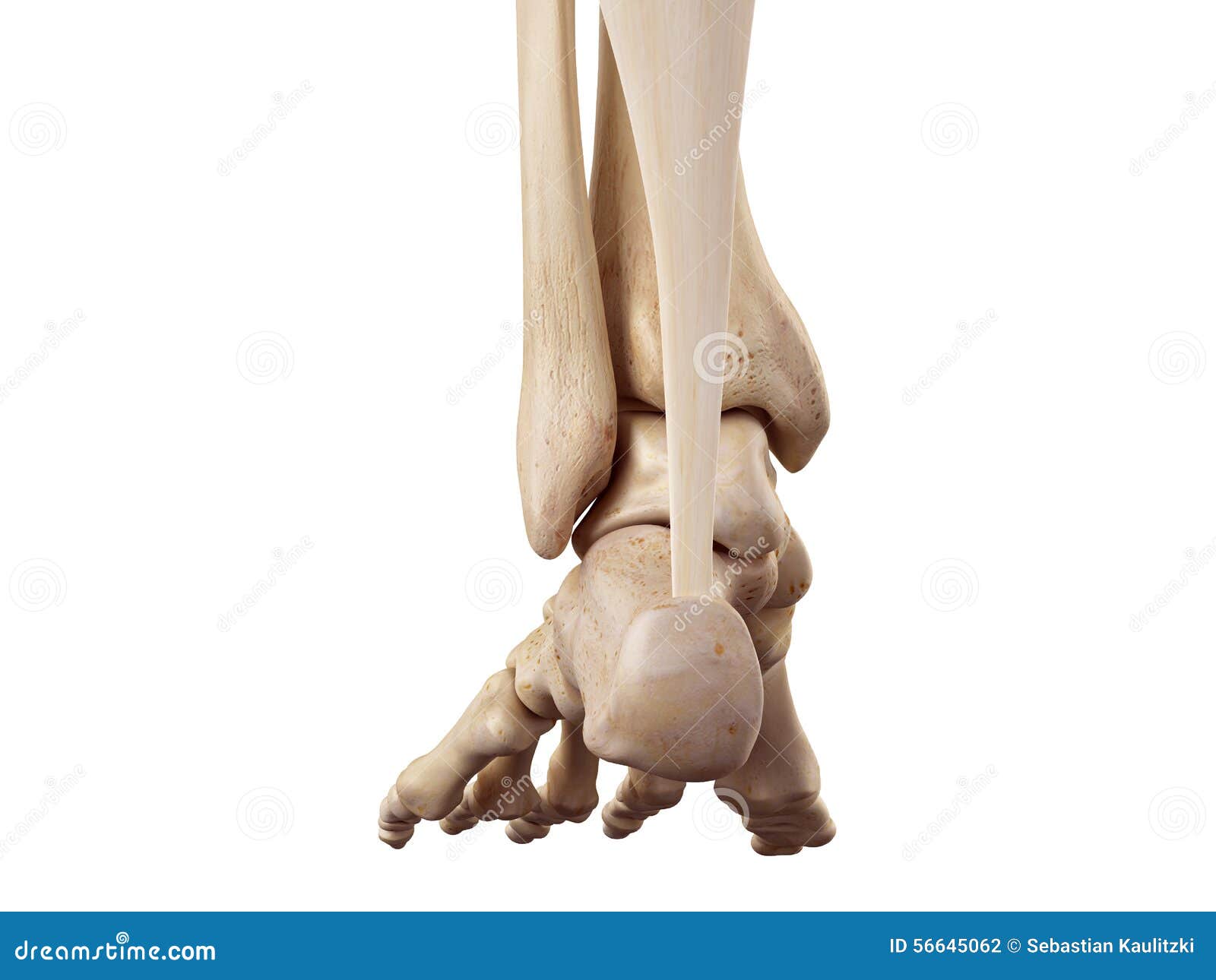 Achilles Tendon Injury Types As Leg Or Ankle Trauma Examples Outline ...