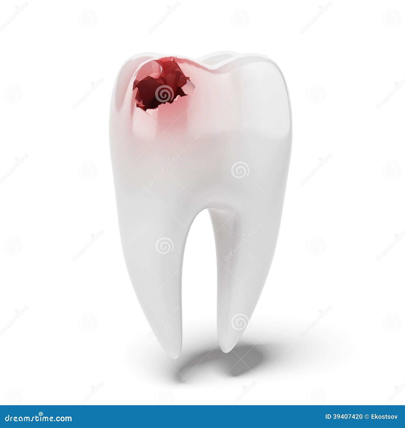 3d Render Of Jaw X-ray With Aching Tooth Royalty-Free Stock Photography ...