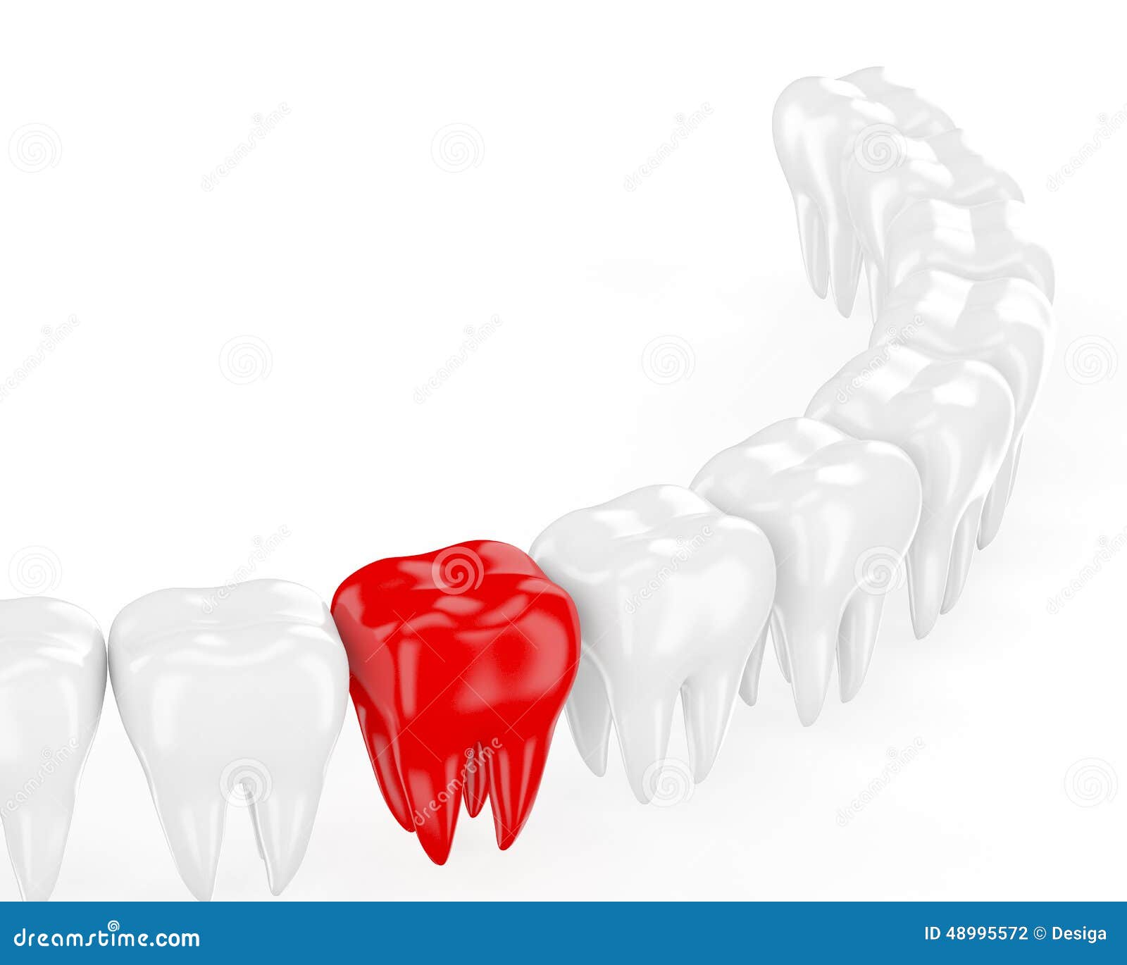 Aching Tooth in Row of Healthy Teeth Stock Illustration - Illustration ...