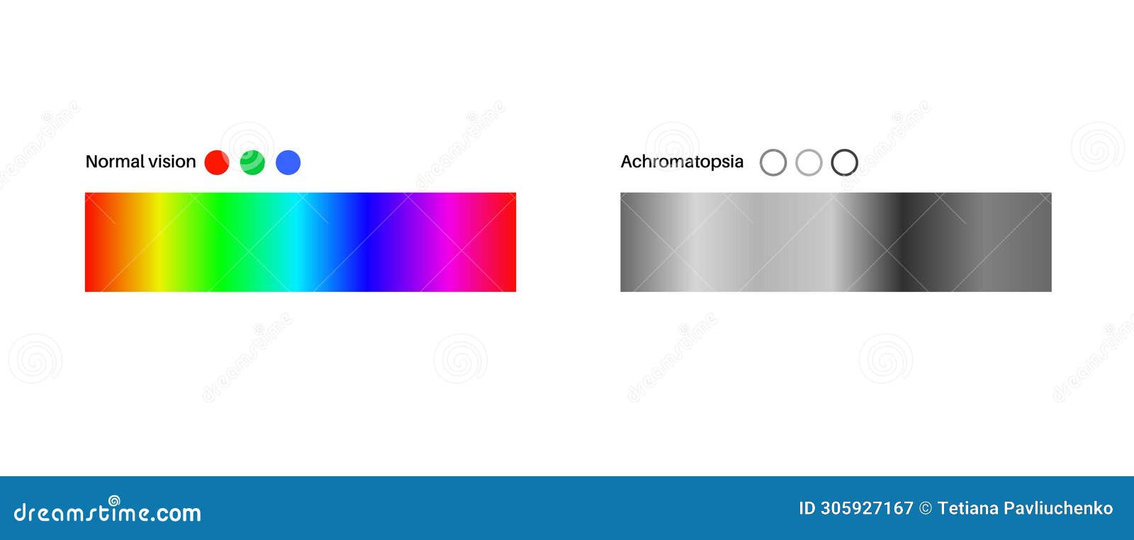 Achromatopsia Vision Deficiency Stock Vector - Illustration of spectrum ...