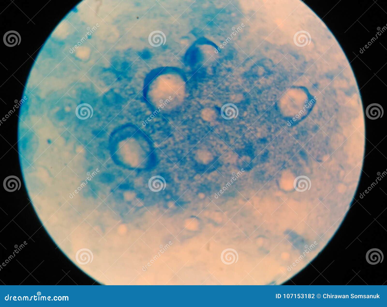 Acid Fast Bacilli Negative on Blue. Stock Photo - Image of microscopy ...