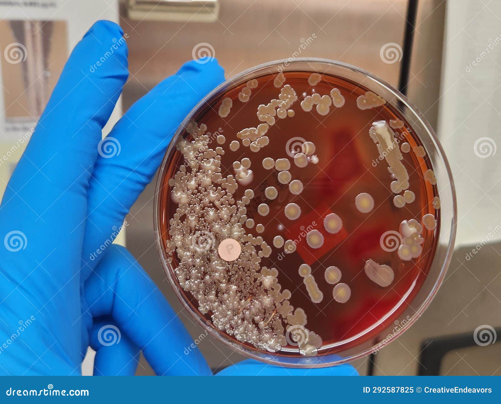 Acinetobacter Antibiotic Resistant Bacterial Colonies on Agar Plate ...