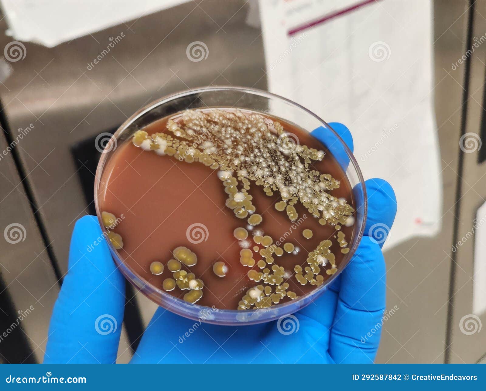 Acinetobacter Antibiotic Resistant Bacterial Colonies on Chocolate Agar ...