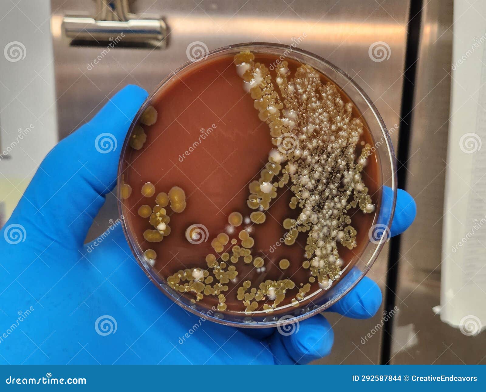 Acinetobacter Antibiotic Resistant Bacterial Colonies on Chocolate Agar ...