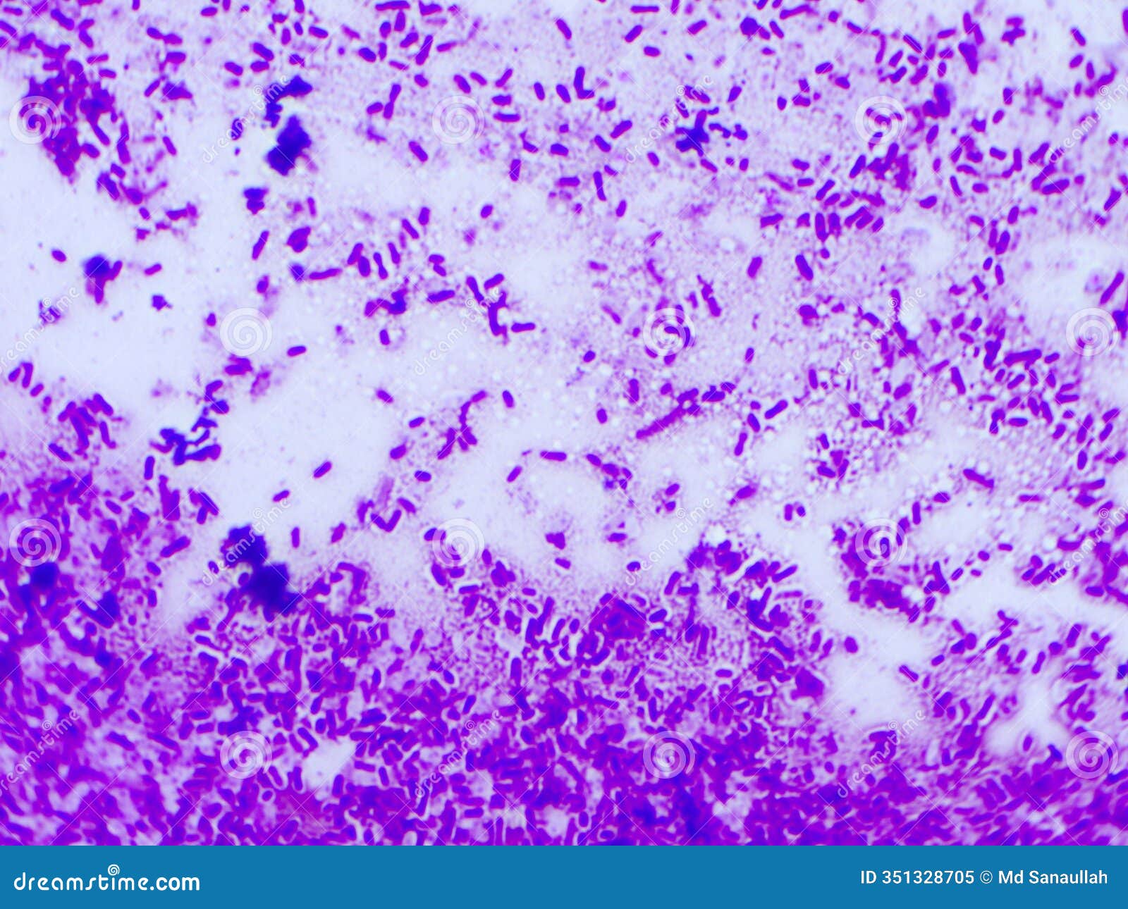 Acinetobacter baumannii stock image. Image of horizontal - 351328705