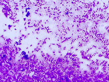 Acinetobacter baumannii stock image. Image of horizontal - 351328705