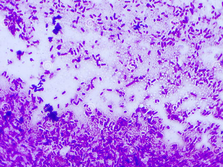 Acinetobacter baumannii stock image. Image of horizontal - 351328705