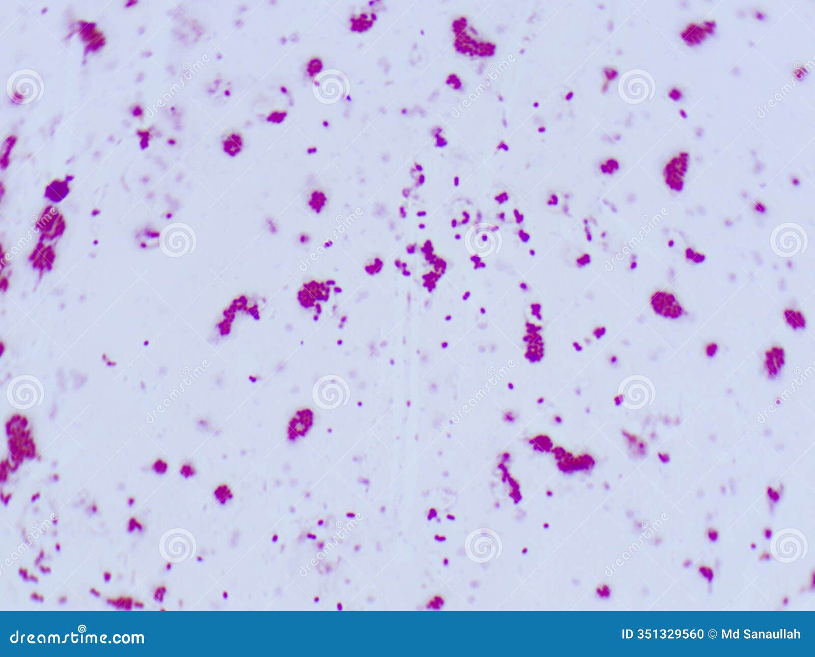 Acinetobacter baumannii stock photo. Image of biotechnology - 351329560