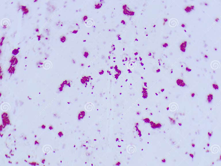 Acinetobacter baumannii stock photo. Image of biotechnology - 351329560