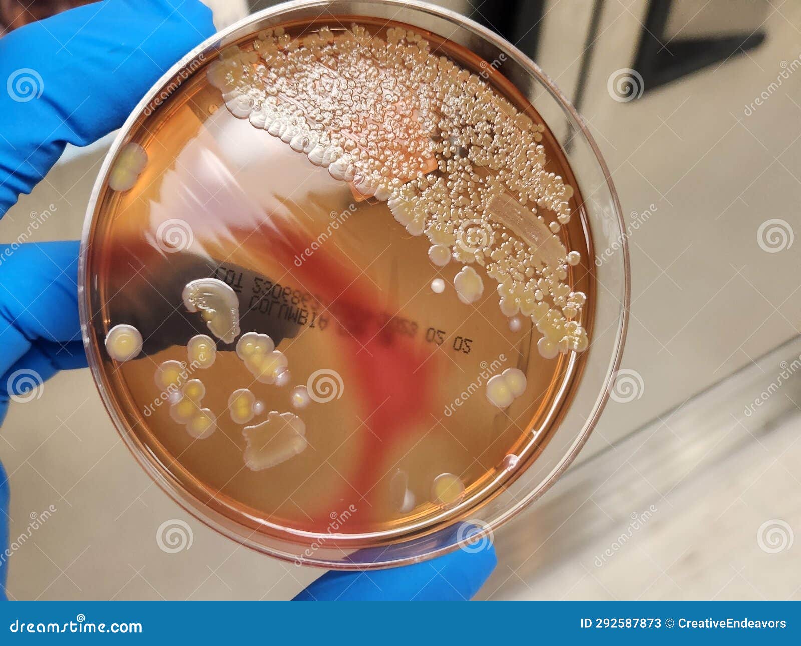 Acinetobacter Hemolytic Bacterial Colonies on Agar Plate Stock Image ...