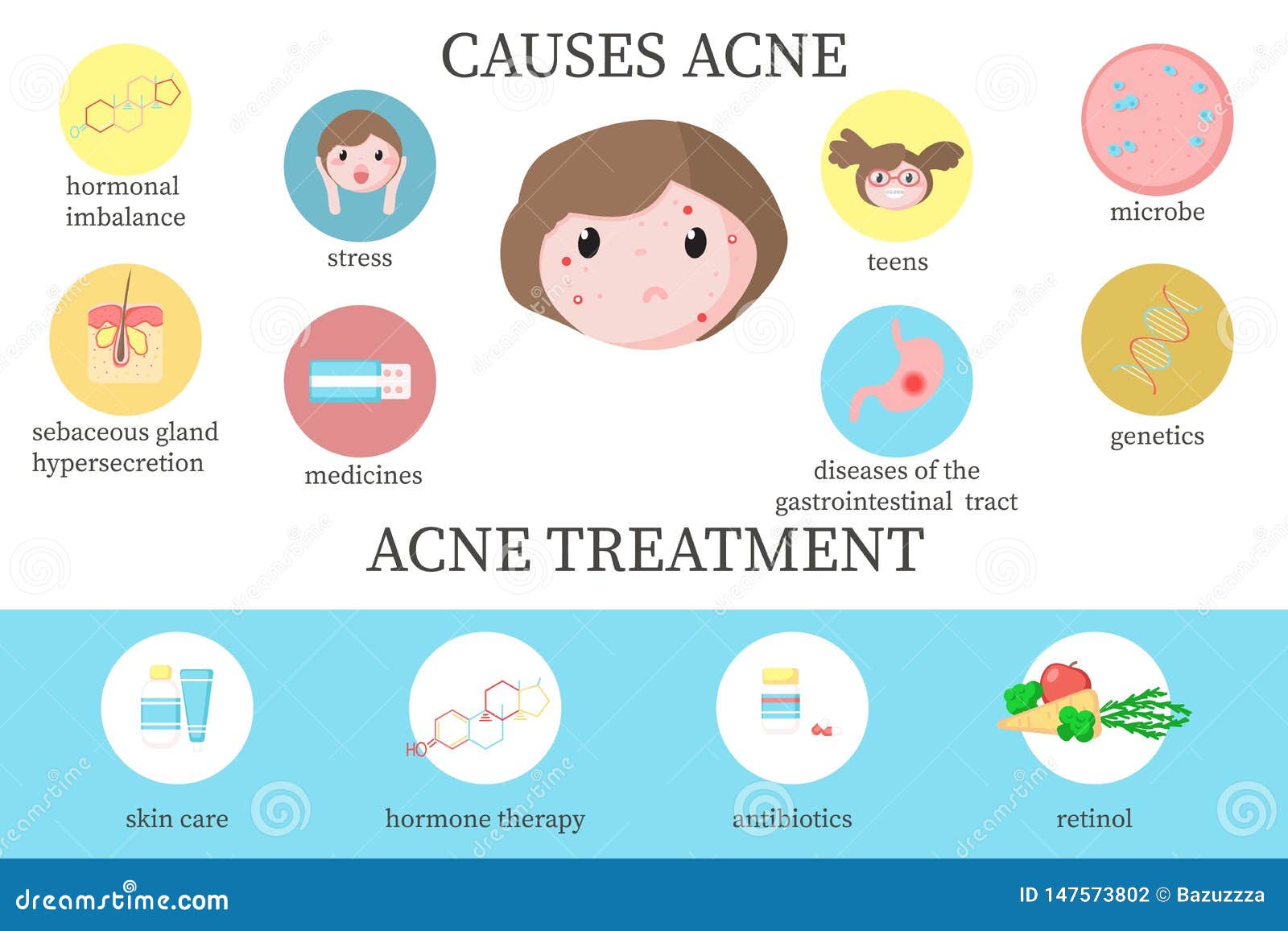 Acne Causes Medical Banner With Dermatology Infographics Girl Problem