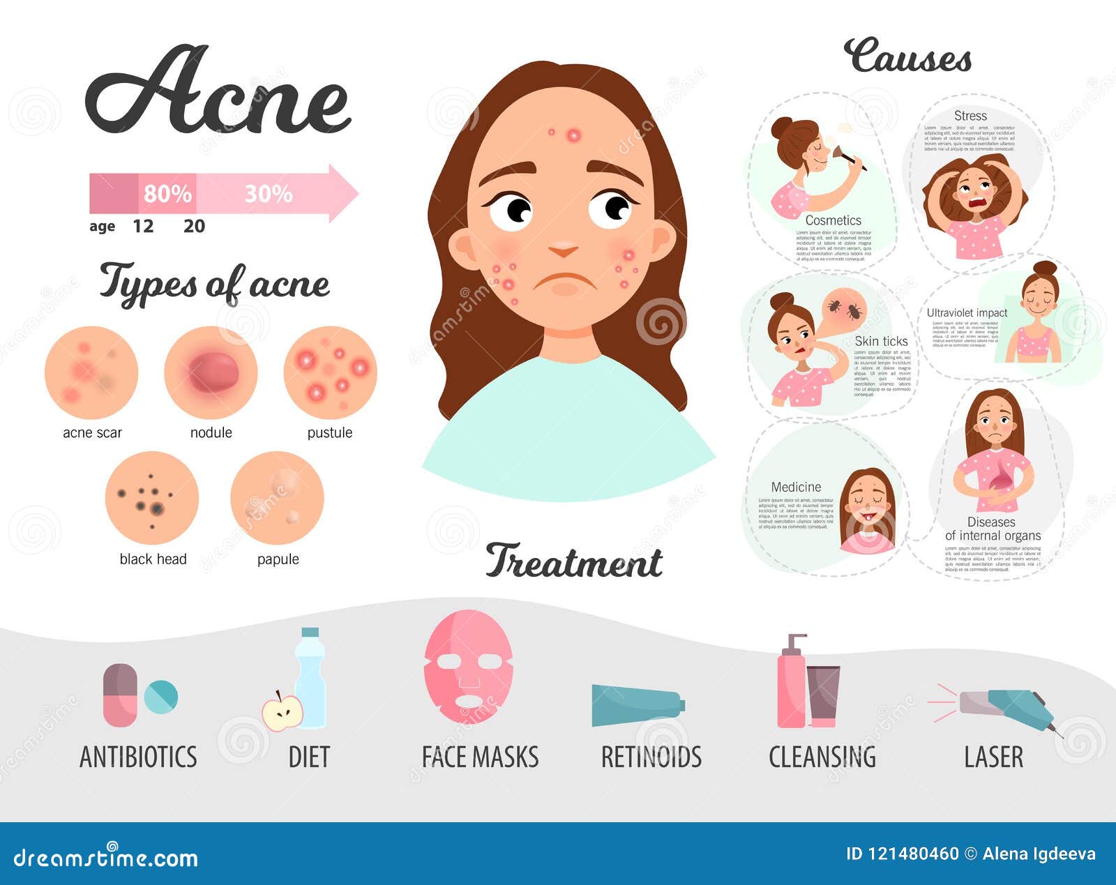 Acne infographics. stock vector. Illustration of black - 121480460