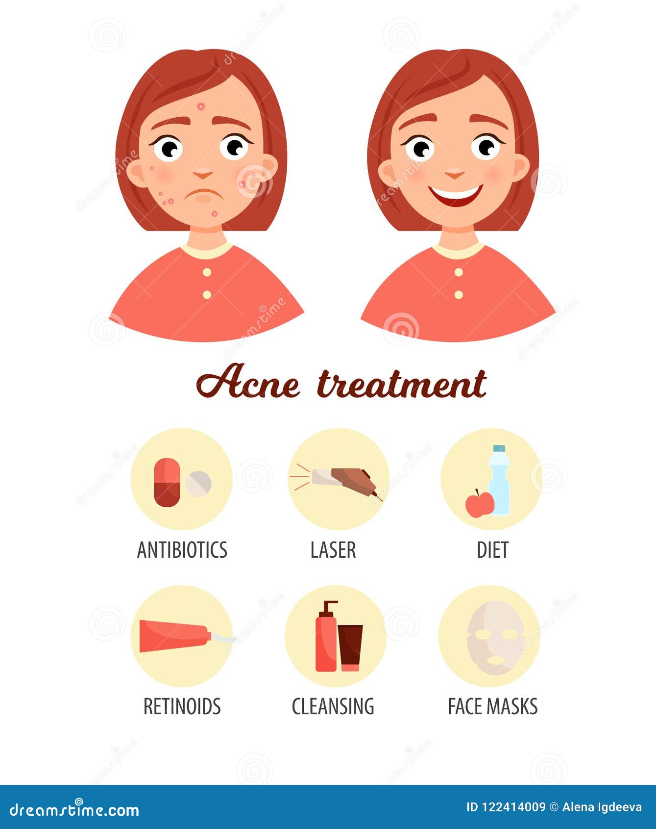 Acne Infographics. Vector Illustration | CartoonDealer.com #123730980