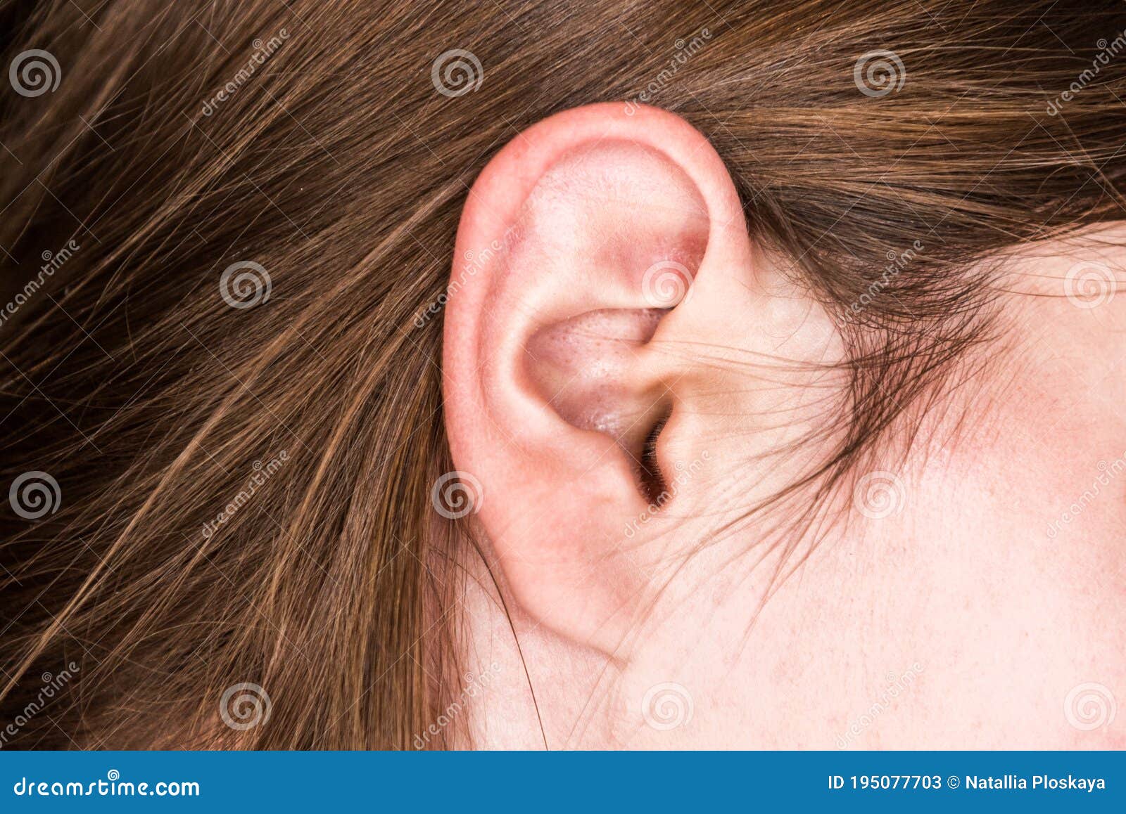 Acne inside the female ear stock image. Image of child - 195077703