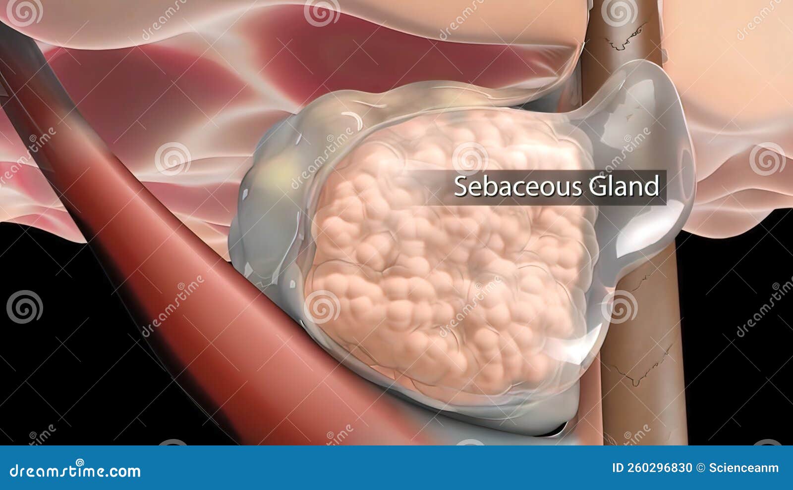 Acne and Pimples, Stages of Development, Graphic Illustration Stock ...